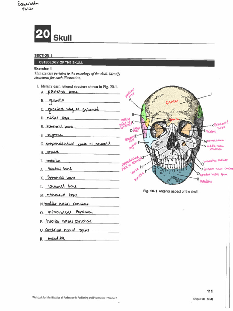 Skull Worksheet - Esmeralda P. 2 | PDF | Otorhinolaryngology | Skull