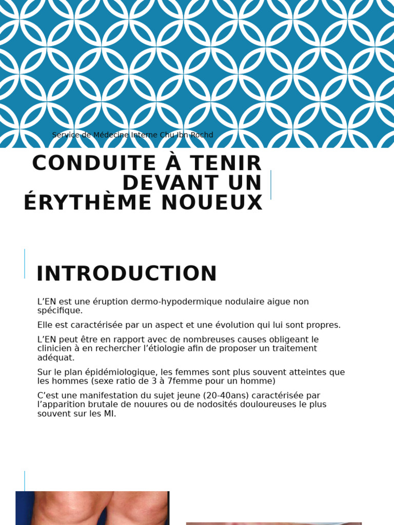 Conduite à tenir face à l'érythème noueux | PDF | Tuberculose ...