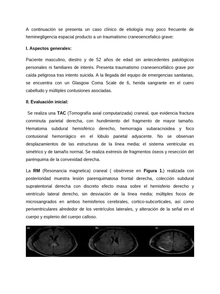 Heminegligencia Espacial Tras TCE Grave | PDF | Lesión cerebral ...