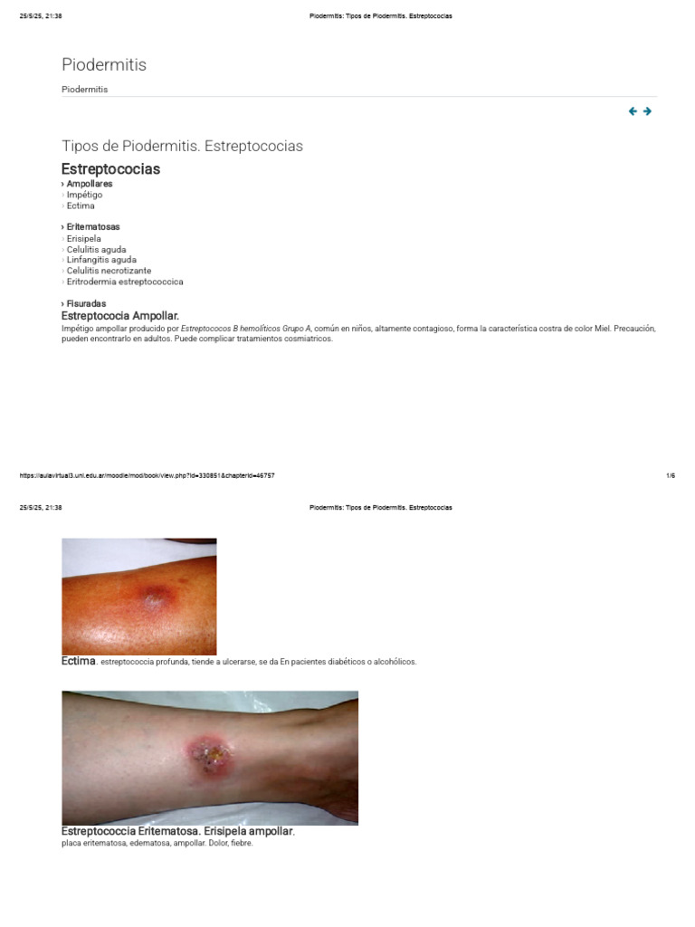 Piodermitis - Tipos de Piodermitis. Estreptococias | PDF | Inmunología ...