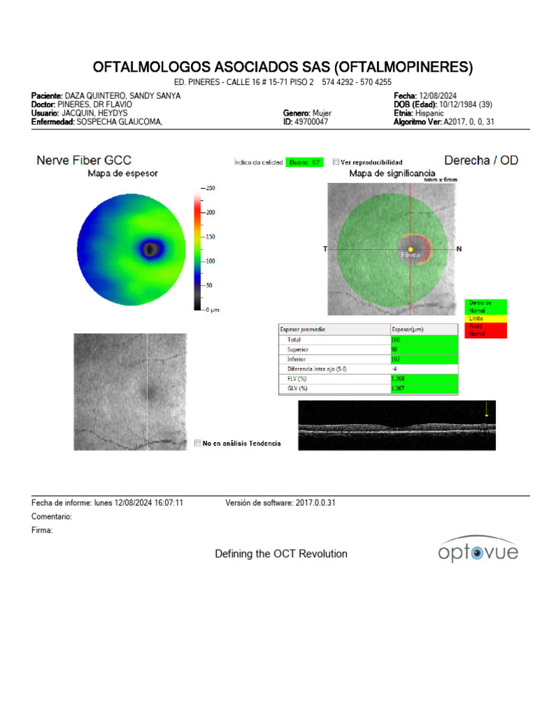 OCT NERVIO - PAQUIMETRIA- SANDY SANYA DAZA QUINTERO (1) | PDF