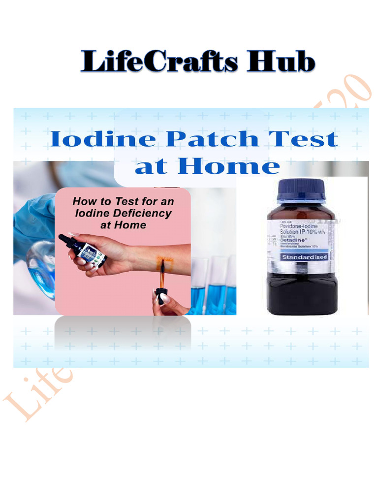 Iodine Patch Test | PDF | Thyroid | Clinical Medicine