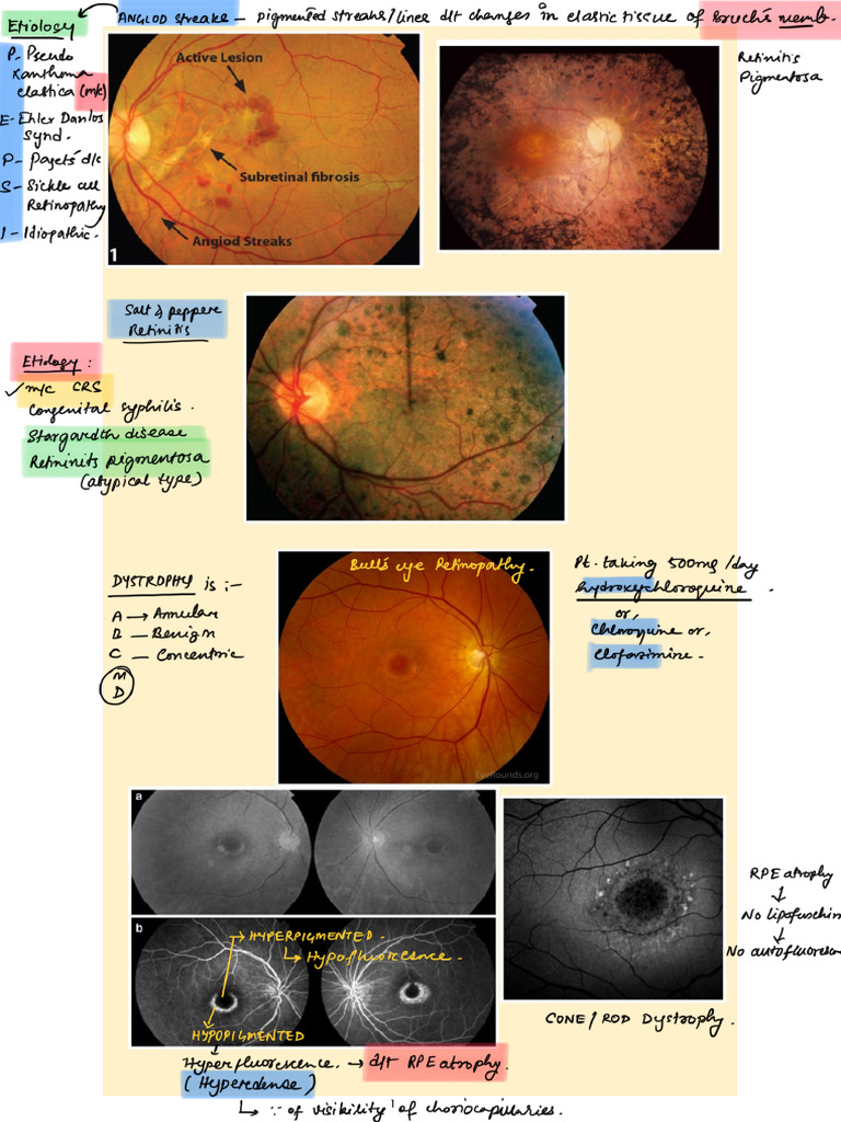 Macula | PDF
