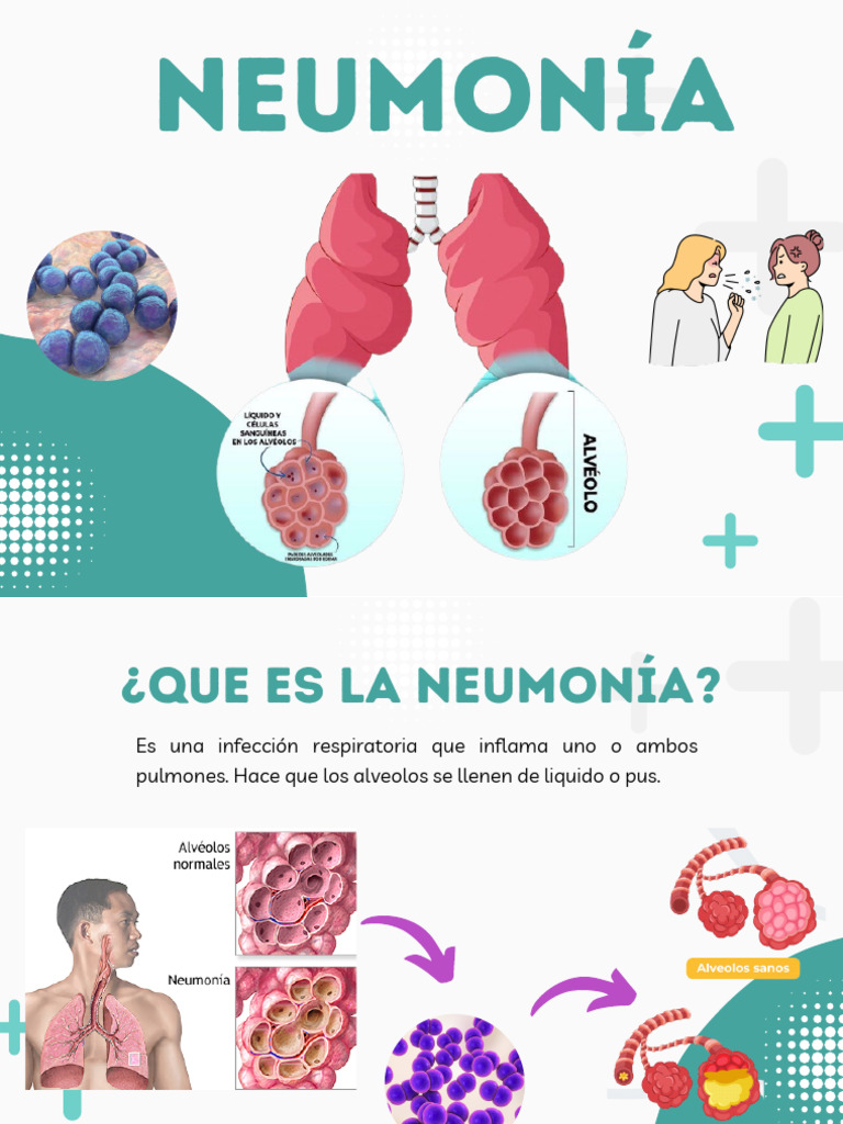 Rotafolio de Neumonia | PDF | Neumonía | Influenza