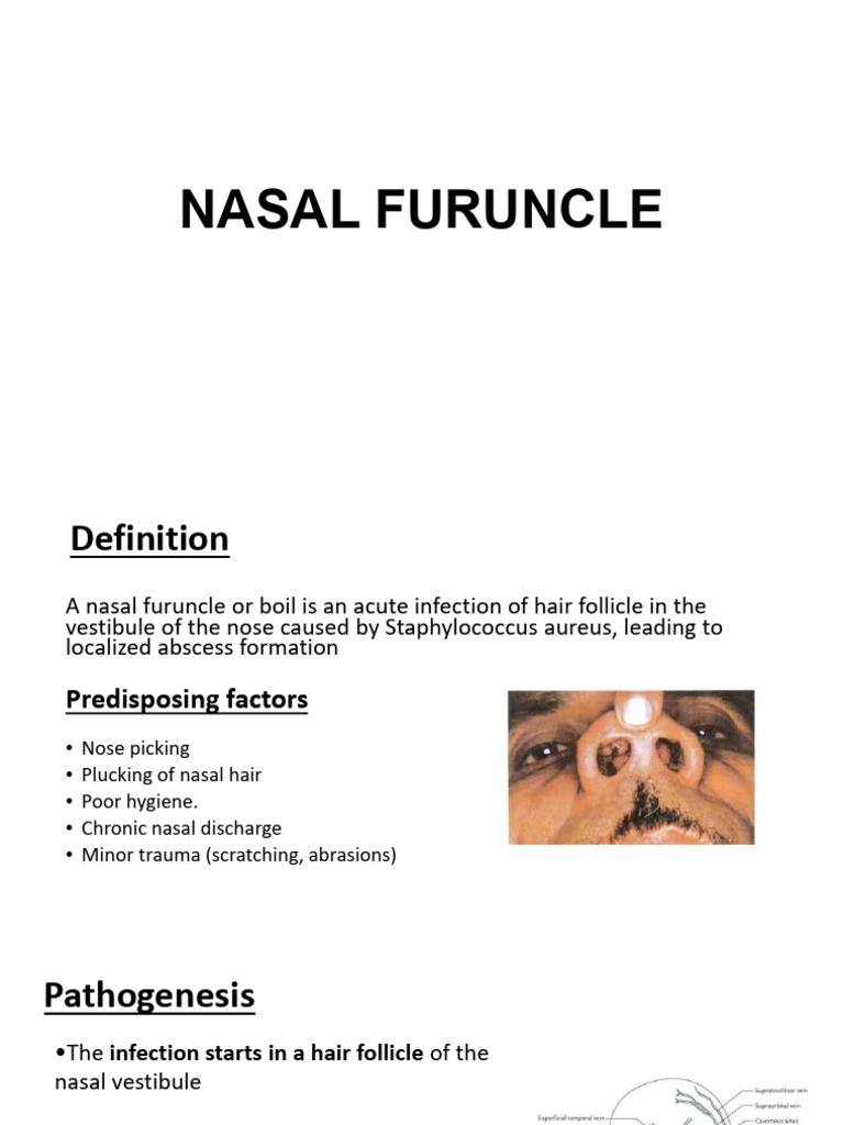 Nasal Furuncle | PDF