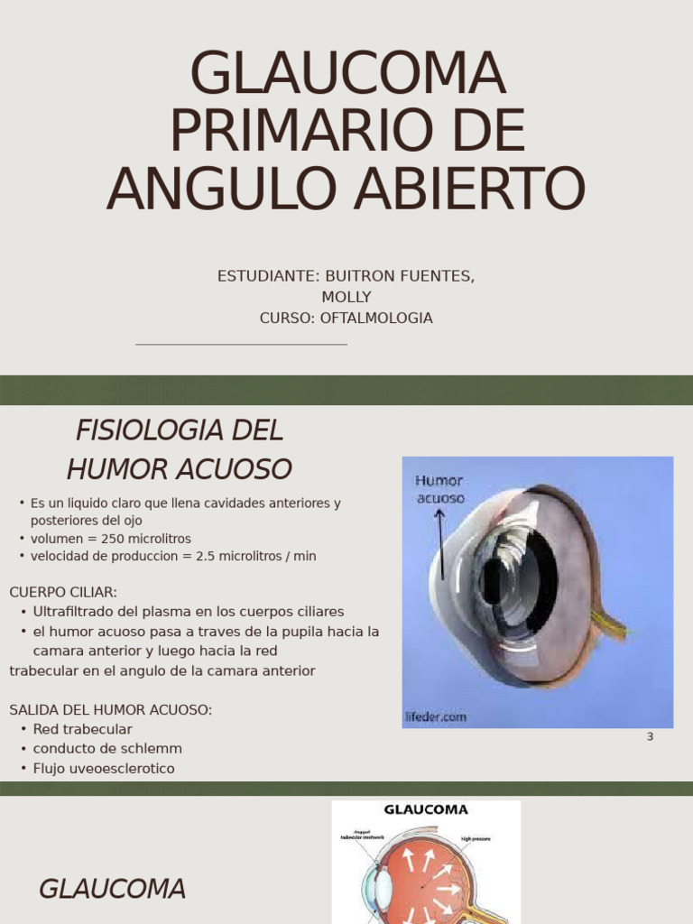 Glaucoma Primario de Angulo Abierto | PDF | Glaucoma | Enfermedades y ...