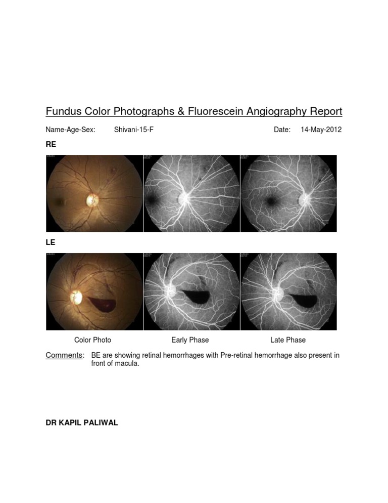 Fundus Photography & Angiography Report | PDF | Wellness | Science ...
