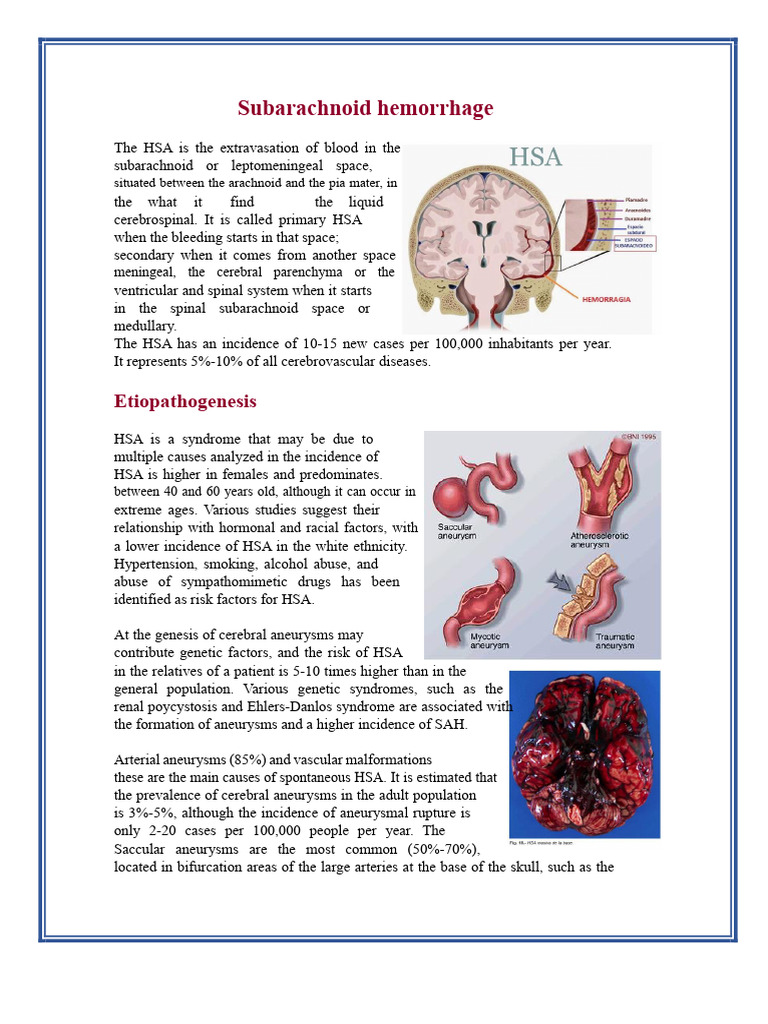 Subarachnoid Hemorrhage | PDF | Stroke | Cardiovascular System