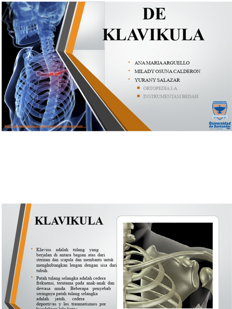 Cara Efektif Mengobati Fraktur Klavikula | PDF