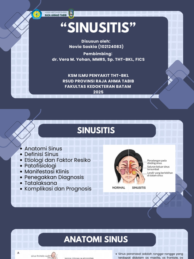 sinusitis | PDF