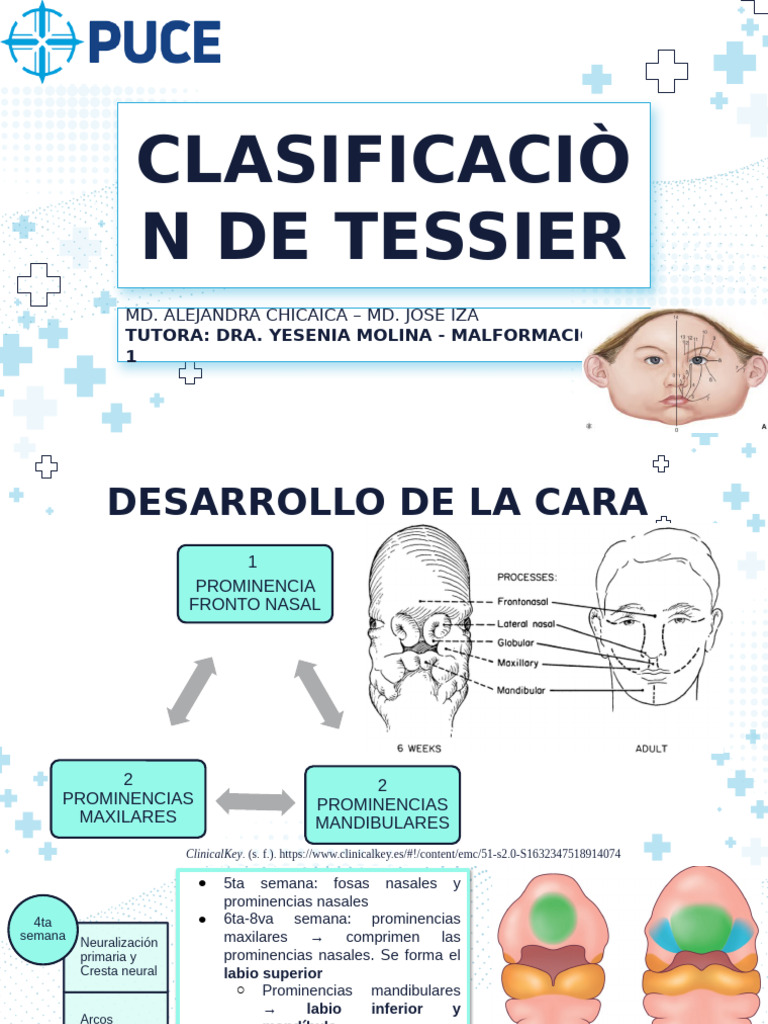 Clasificacion de Tessier | PDF | Cráneo | Cabeza y cuello humanos