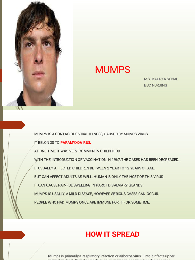 Mumps | PDF