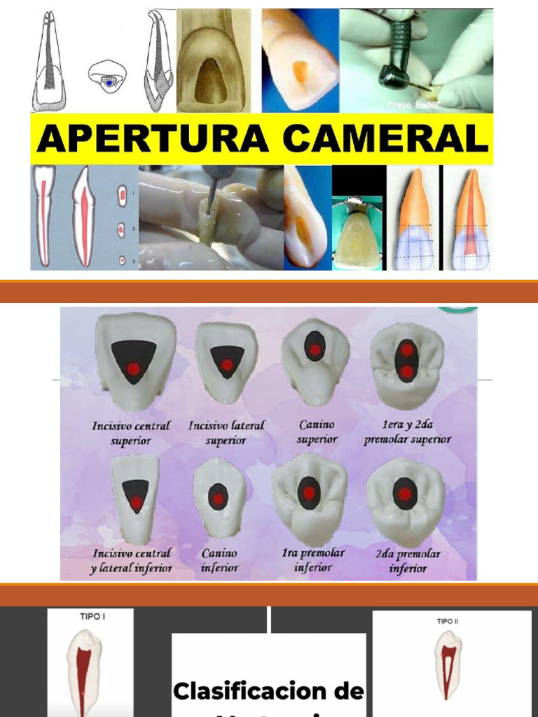 2. Apertura Cameral | PDF