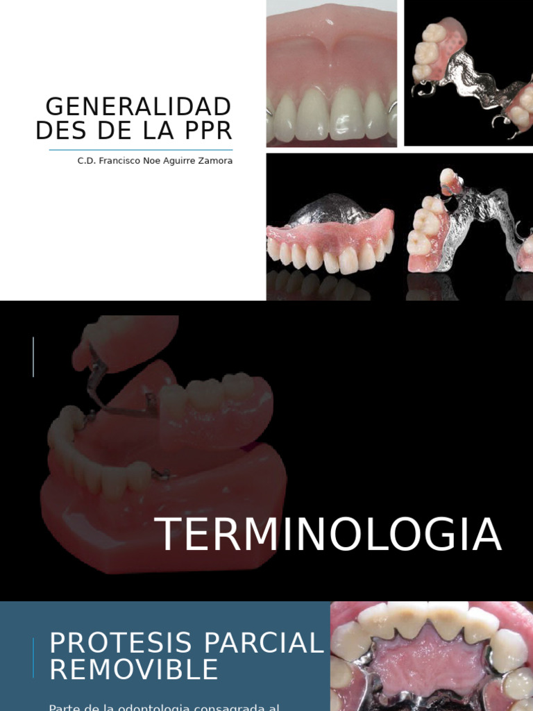 Terminología y Clasificación de PPR | PDF | Odontología | Boca