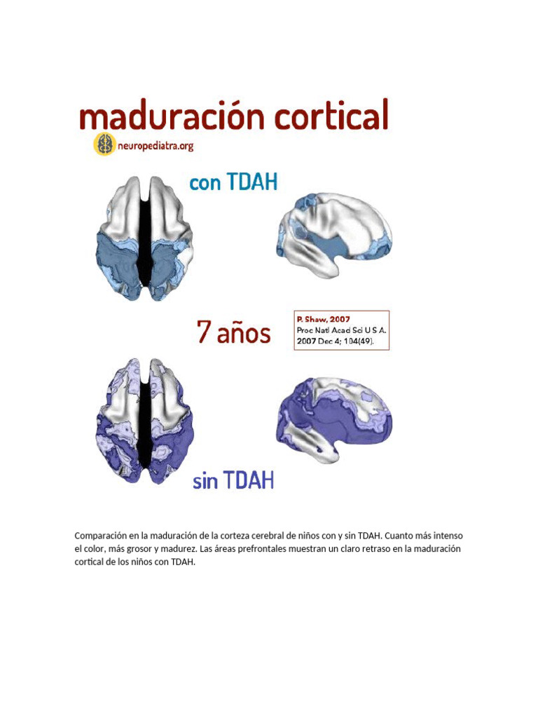 Cerebro Con TDAH | PDF