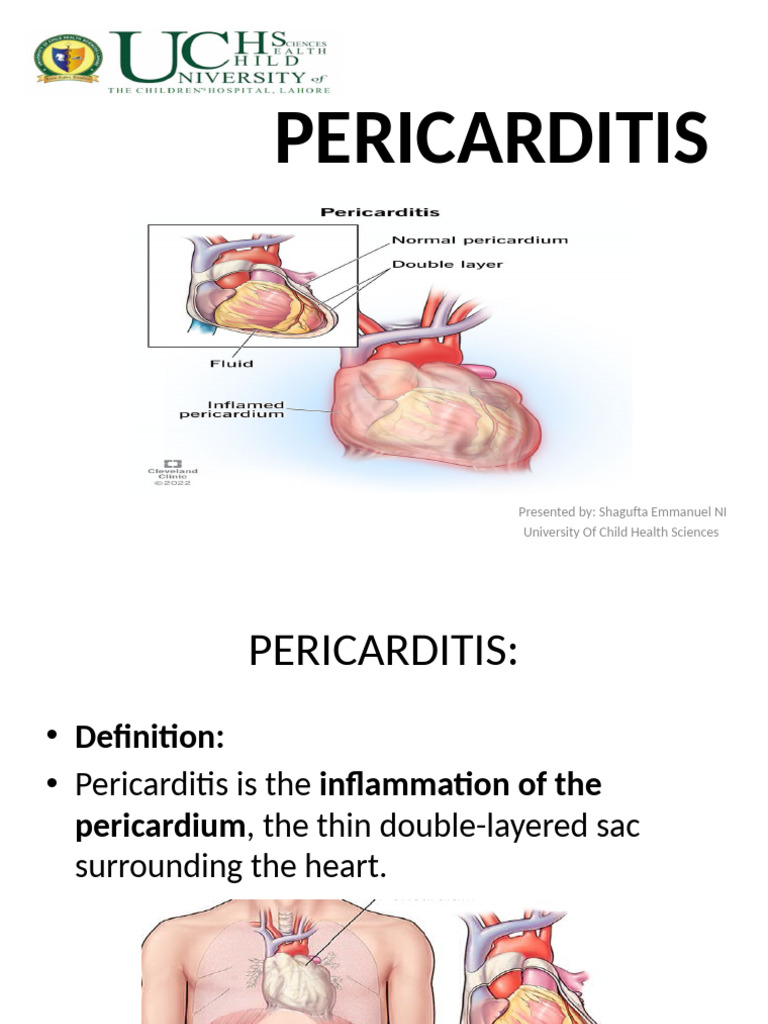 Understanding Pericarditis Causes & Management | PDF | Heart | Heart ...