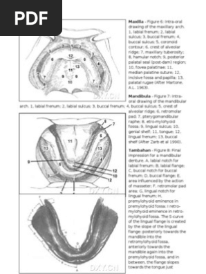 Retromylohyoid Space
