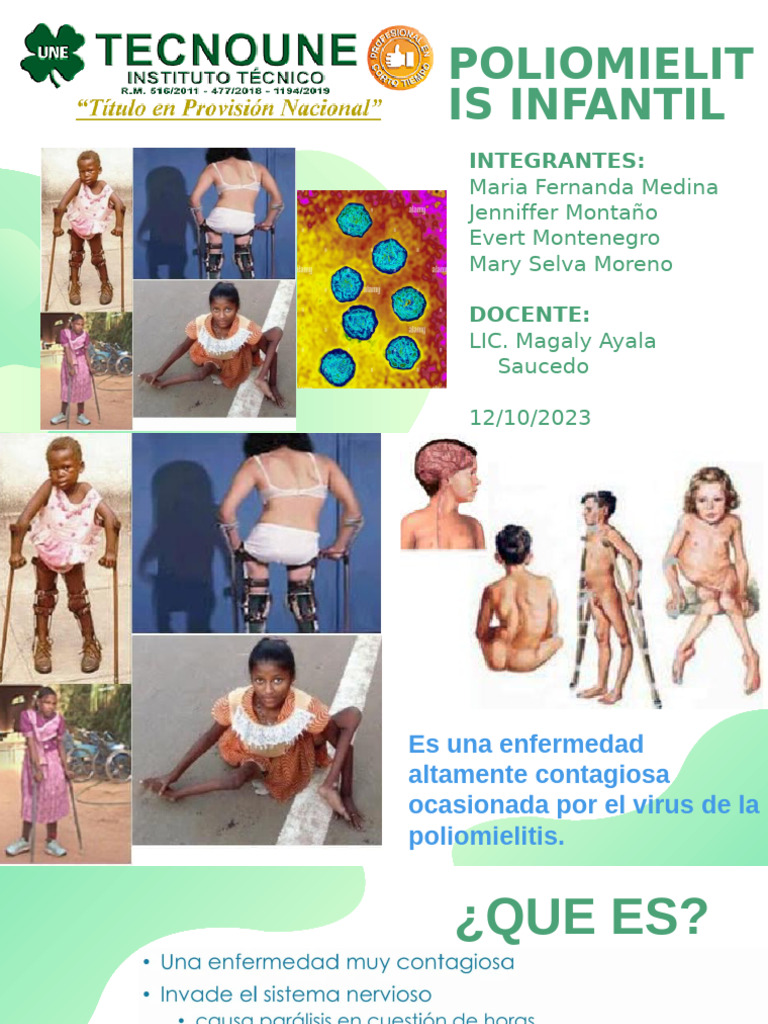 Poliomielitis Infantil: Información Clave | PDF