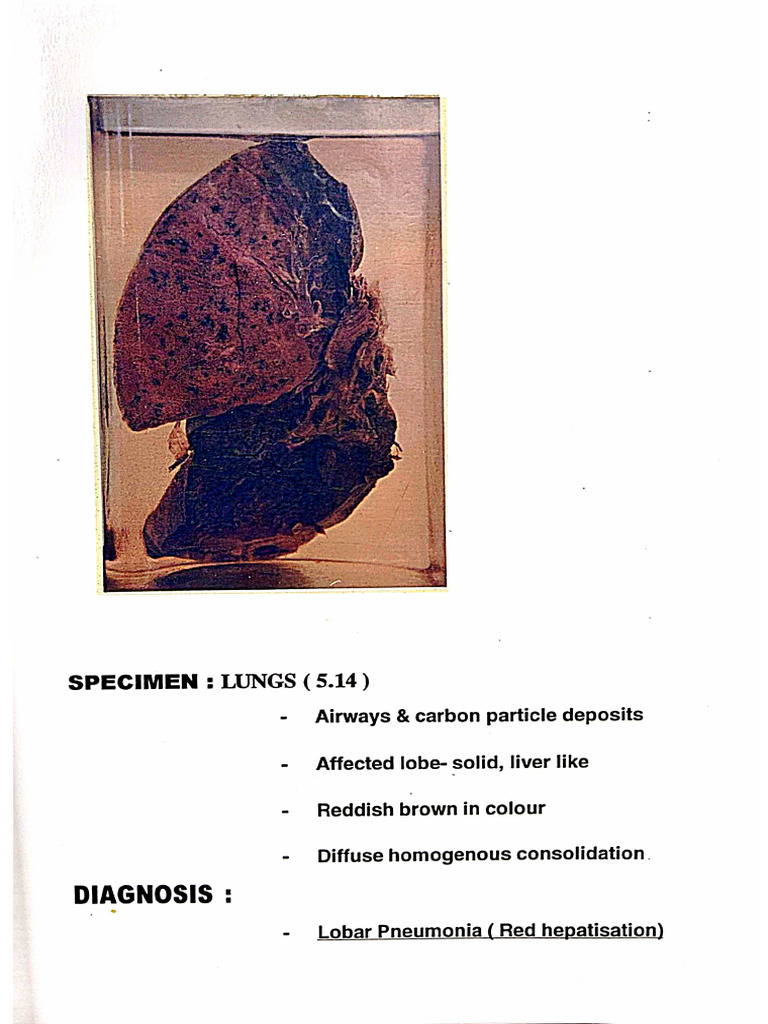 Lungs Specimen | PDF