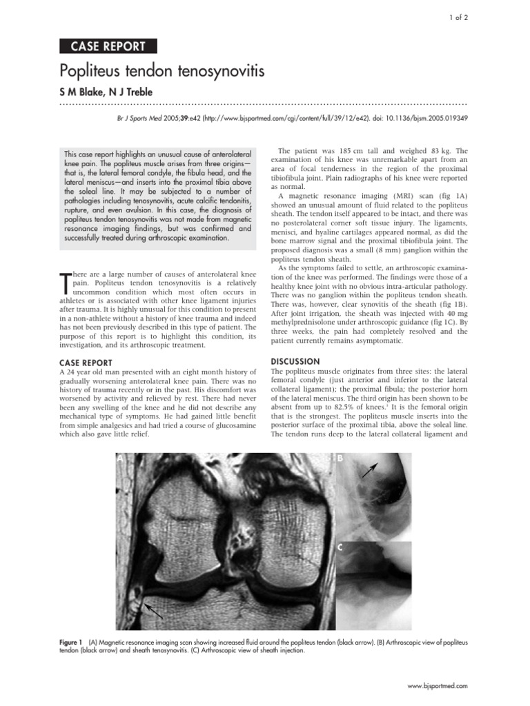 Popliteus Tenosynovitis Case Report | PDF | Knee | Musculoskeletal ...