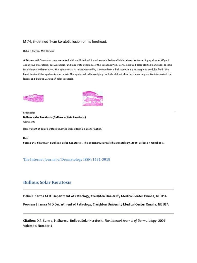 Bullous Solar Keratosis (Bullous Actinic Keratosis) | PDF | Cutaneous ...