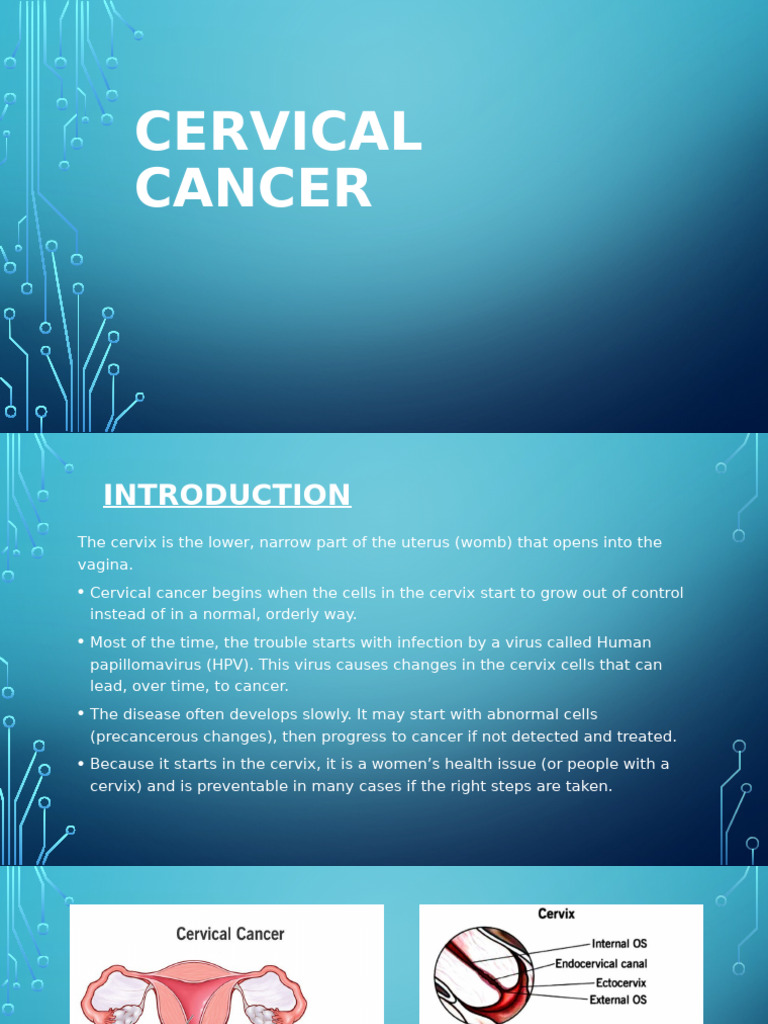 Cervical Cancer: Causes, Risks, and Prevention | PDF | Cervical Cancer ...