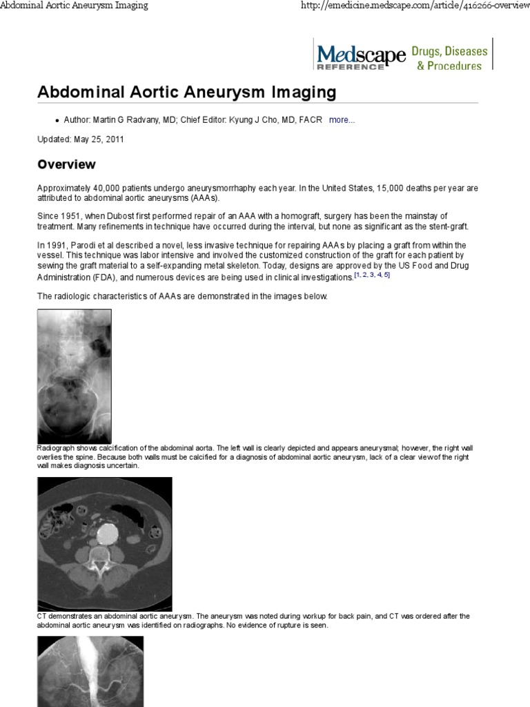 Abdominal Aortic Aneurysm Imaging | PDF | Angiography | Ct Scan