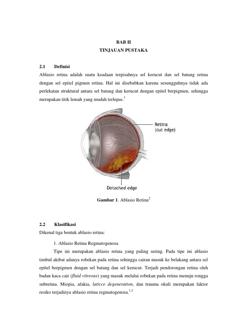Ablatio Retina | PDF