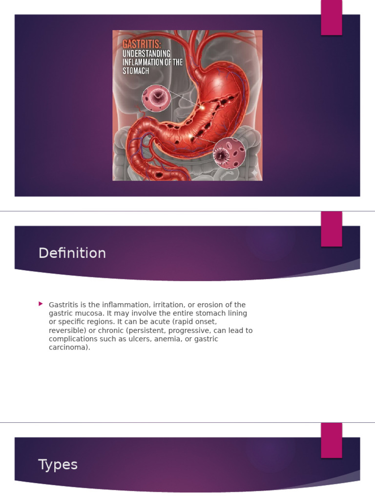 Gastritis-2 Practice of Medicine Inflammation of Gastric Mucosa | PDF ...