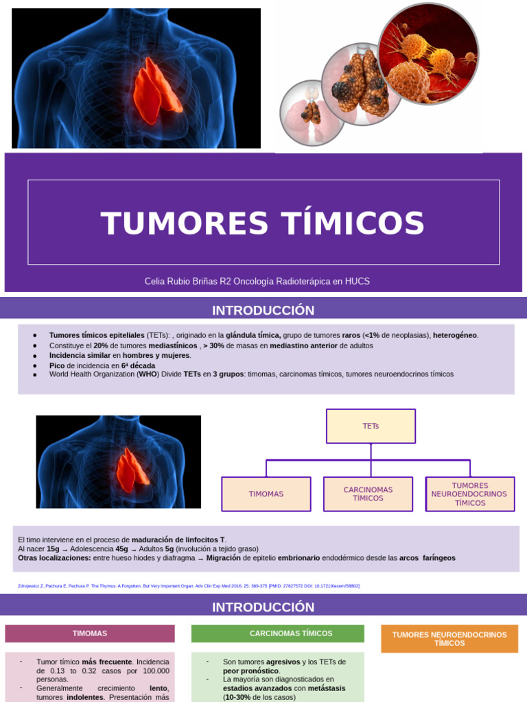 2025. Tumores tímicos | PDF | Cáncer | Neoplasias
