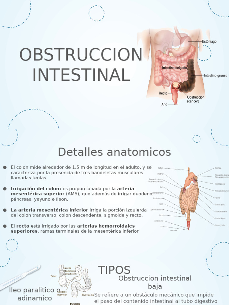 Obstrucción Intestinal: Tipos y Causas | PDF | Intestino grueso ...