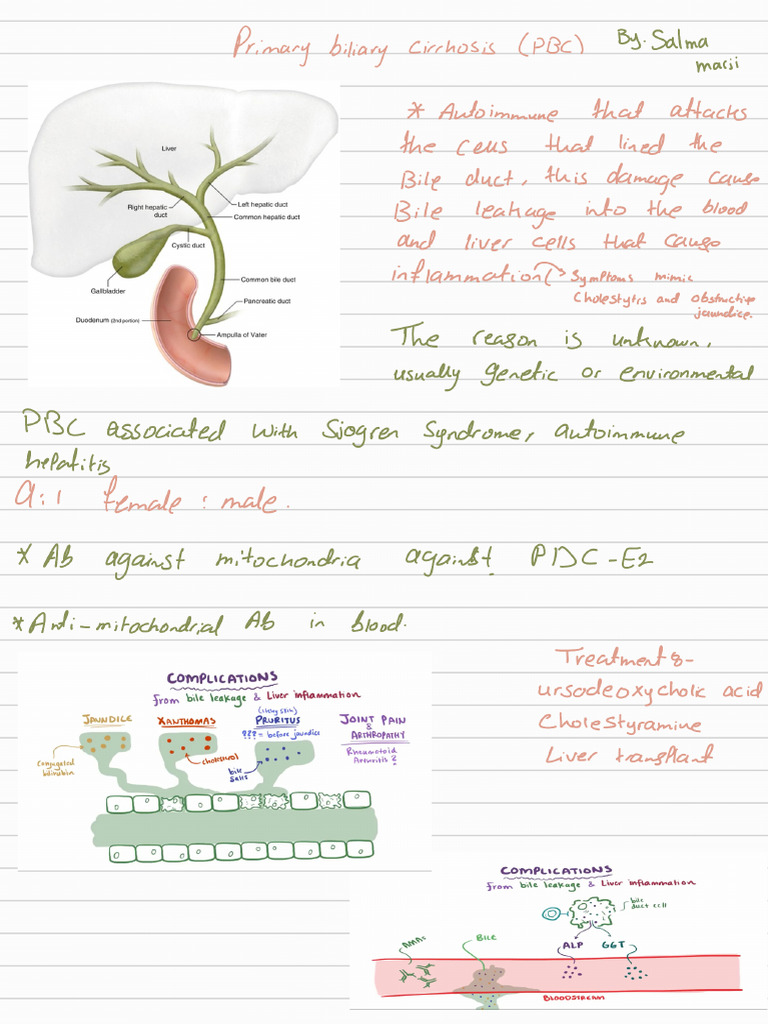 Primary Biliary Cholangitis Pdf