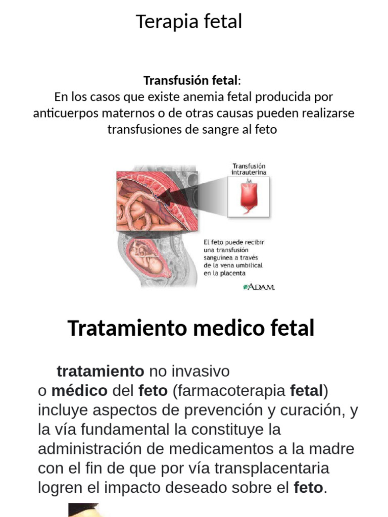 Transfusión Fetal 4 | PDF