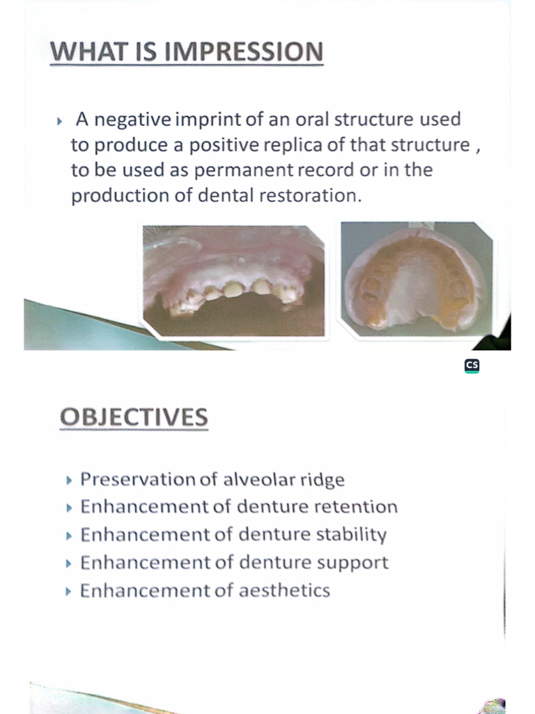 Prostho Impression | PDF