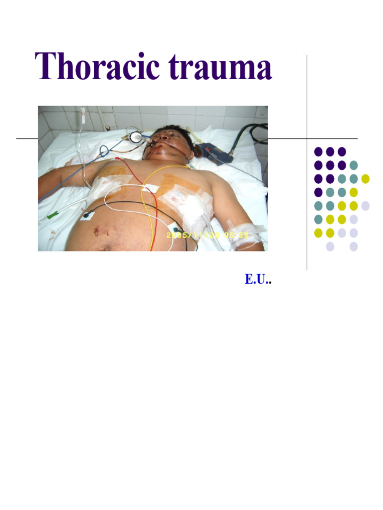 Class 12. Thoracic Trauma. | PDF | Thorax | Major Trauma