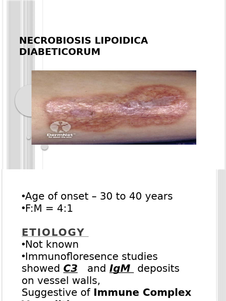 Necrobiosis Lipoidica & Granuloma Annulare | PDF