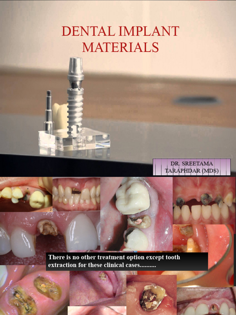 Dental Implant Materials | PDF | Dental Implant | Titanium