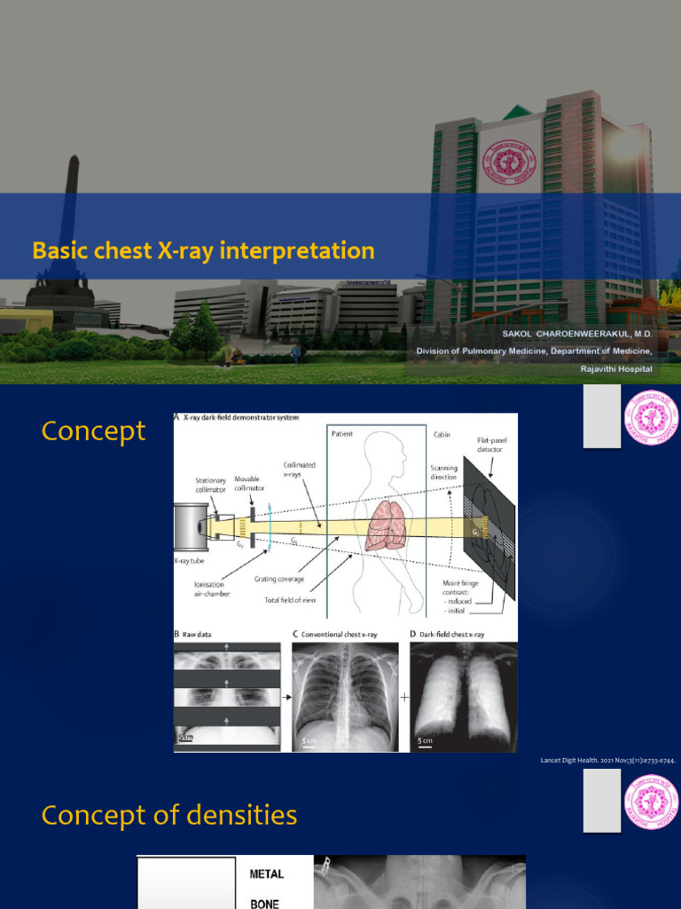 Basic CXR Interpretation | PDF | Lung | Respiratory System