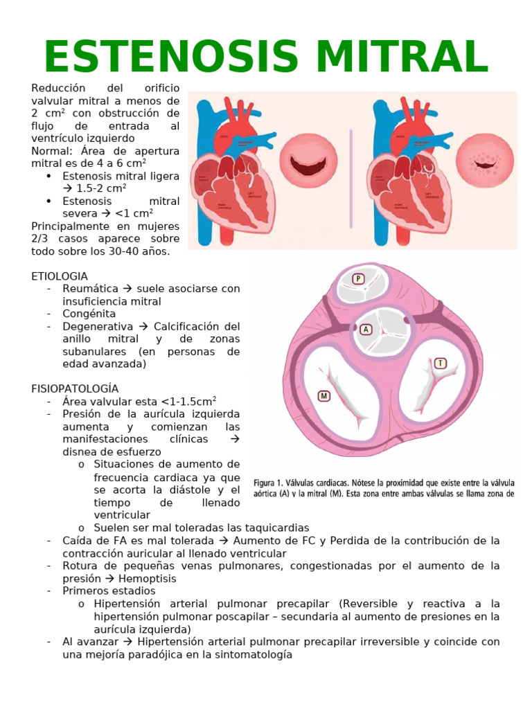 14 Estenosis Mitral Pdf Enfermedades Y Trastornos Cardiología