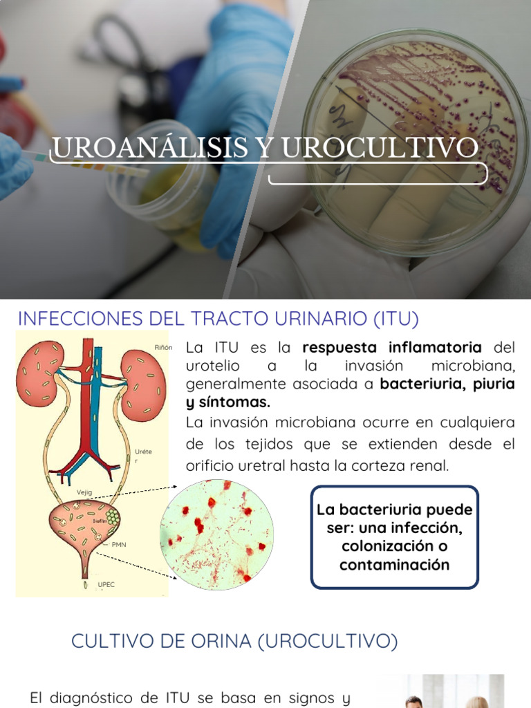 Uro Cult Ivo | PDF | Infección del tracto urinario | Medicina CLINICA