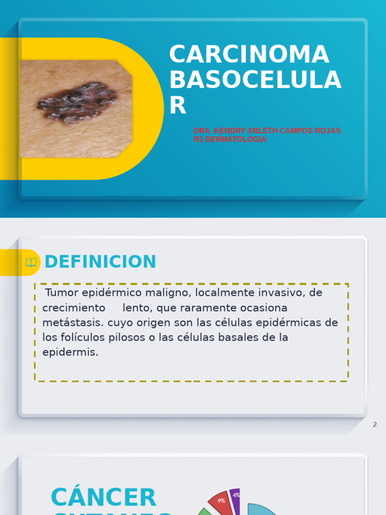Ca. Basocelular | PDF | Cáncer | Cáncer de piel