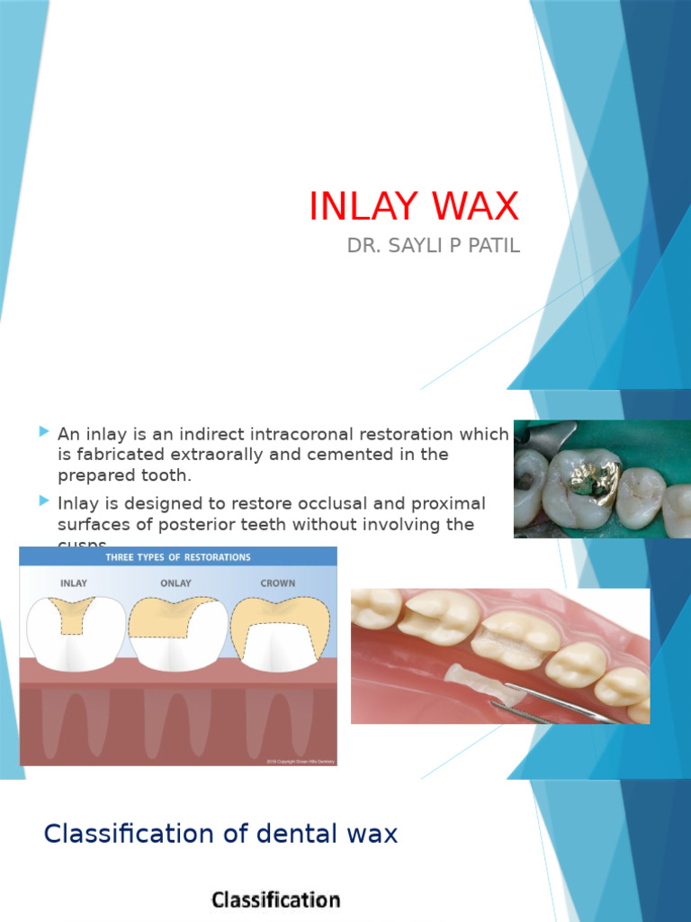 Inlay Wax | PDF | Wax | Materials