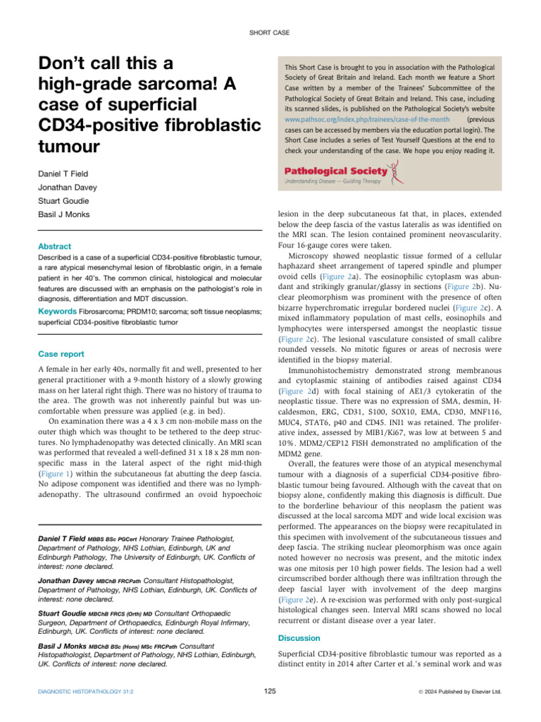 Fibroblastic Tumer | PDF | Pathology | Neoplasms