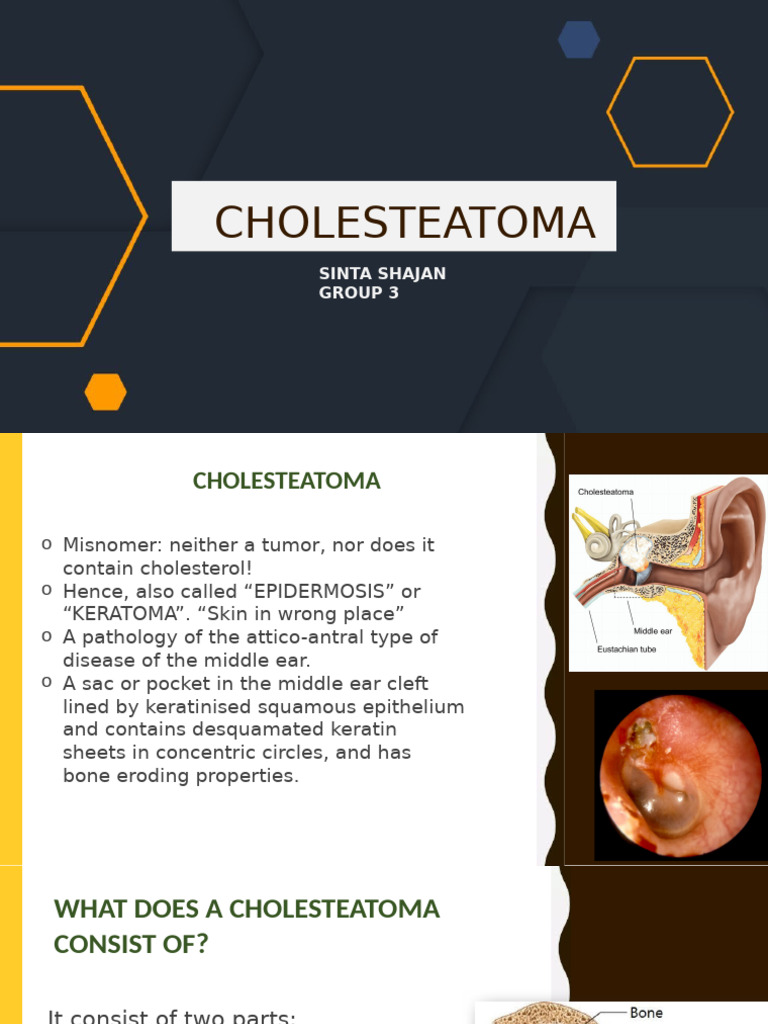Understanding Cholesteatoma: Causes & Treatment | PDF | Ear | Otology