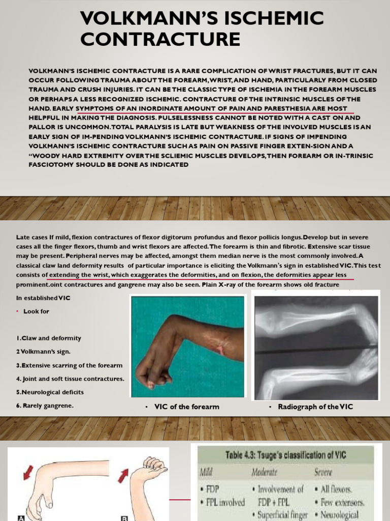 Volkmann'S Ischemic Contracture Is A Rare Complication of Wrist | PDF ...