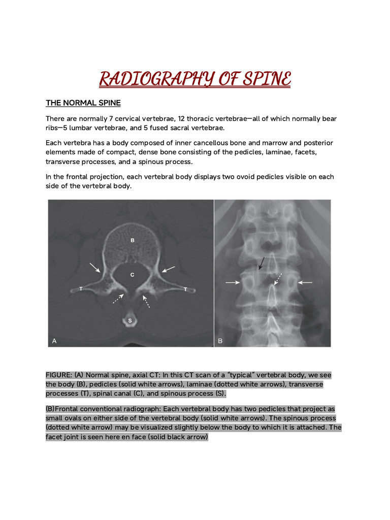 Radiography of Spine | PDF | Vertebra | Musculoskeletal System