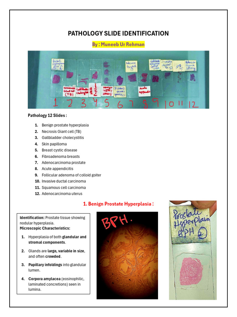 Pathology Slide Identification Guide | PDF | Epithelium | Adenocarcinoma