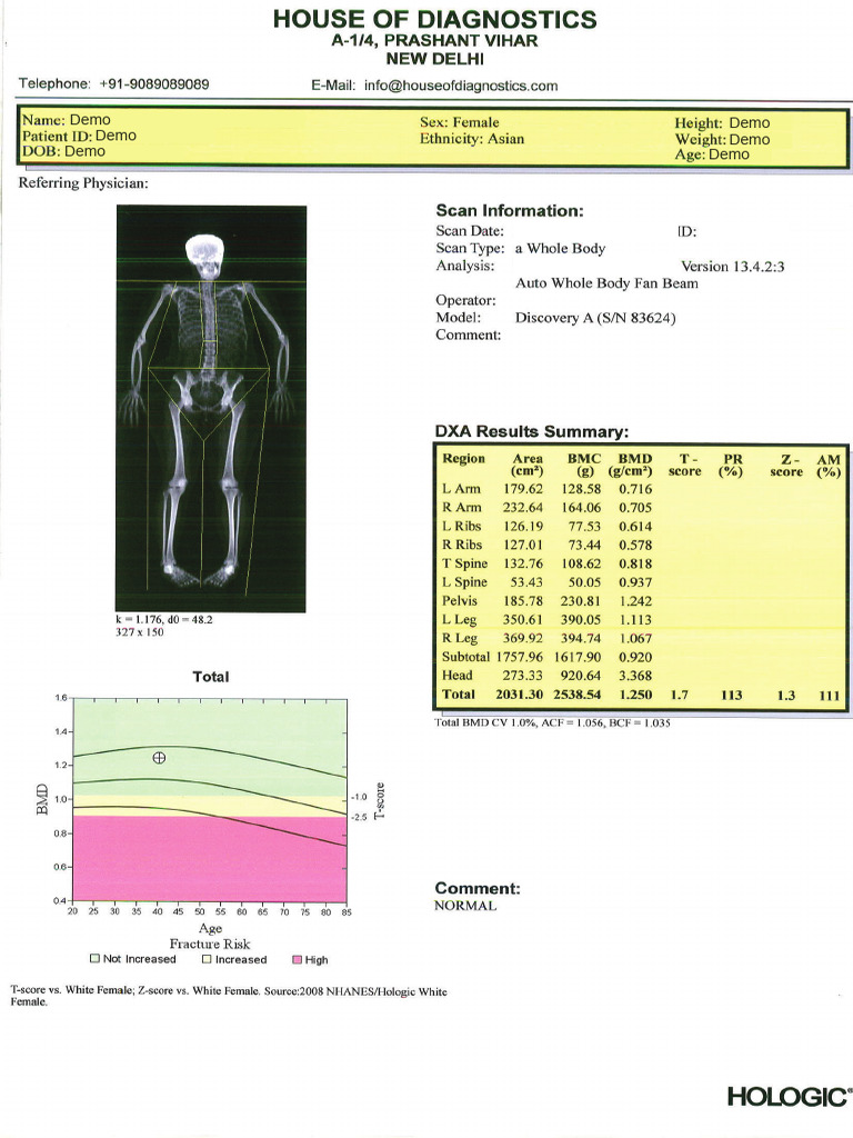 Dexa Sample Report | PDF