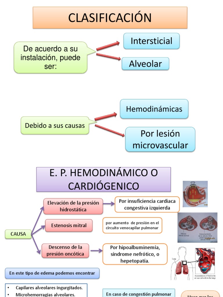 CLASIFICACIÓN de edema | Edema | Inflamación