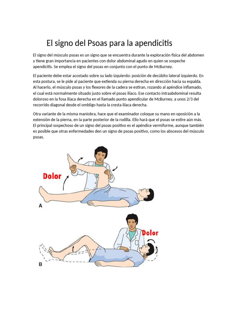 Signo del Psoas y Apendicitis | PDF